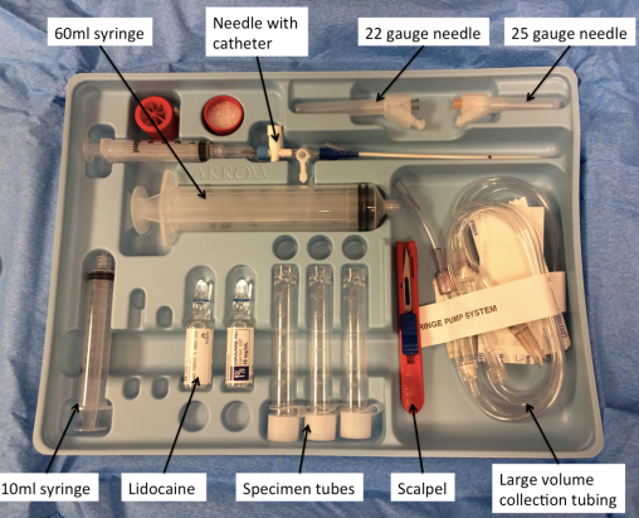 Diagnostics and Therapeutics: Thoracentesis in the Emergency Department ...