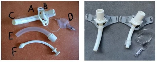 Diagnostics and Therapeutics: Tricks of the Trach — Taming the SRU