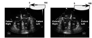 Scanning School - TEE Basics: The Controls and the Views — Taming the SRU