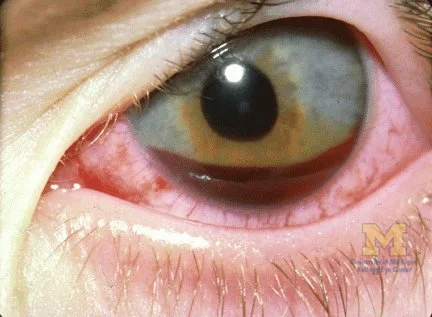 Diagnostics: Ophthalmologic Trauma — Taming the SRU