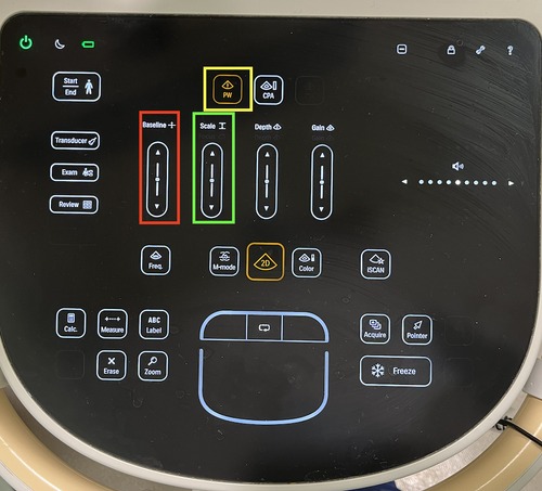 A Finger on the Pulse or An Ultrasound Probe on the Pulse? — Taming the SRU