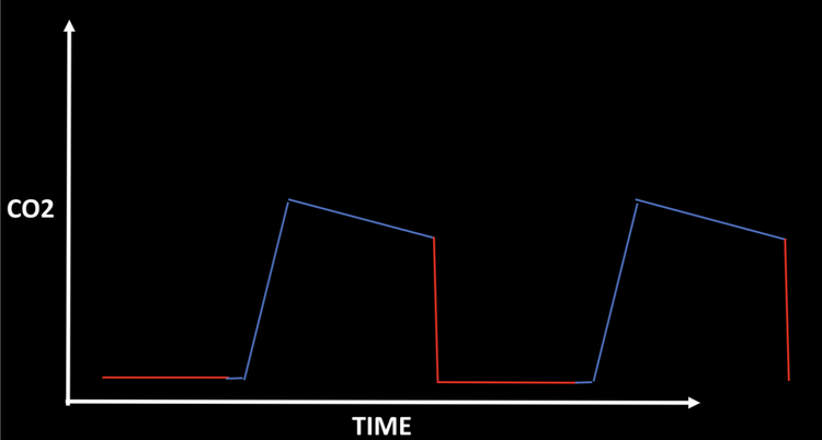Riding the Waves: End-Tidal CO2 Monitoring — Taming the SRU