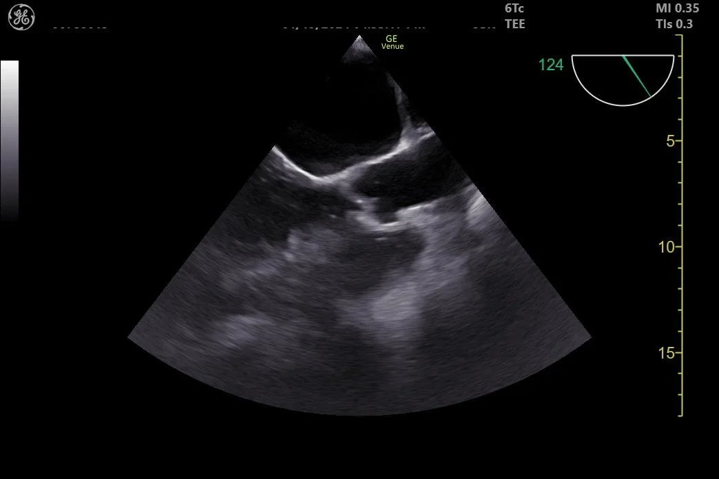 Scanning School - TEE Advanced: Cardiac Arrest Evaluation — Taming the SRU