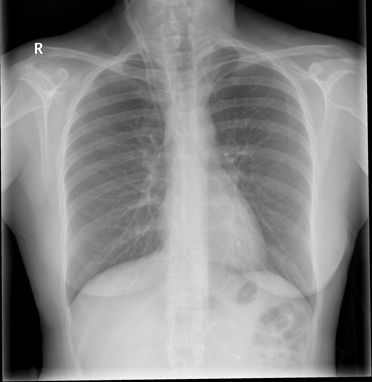Diagnostics: The Shunt Series — Taming the SRU