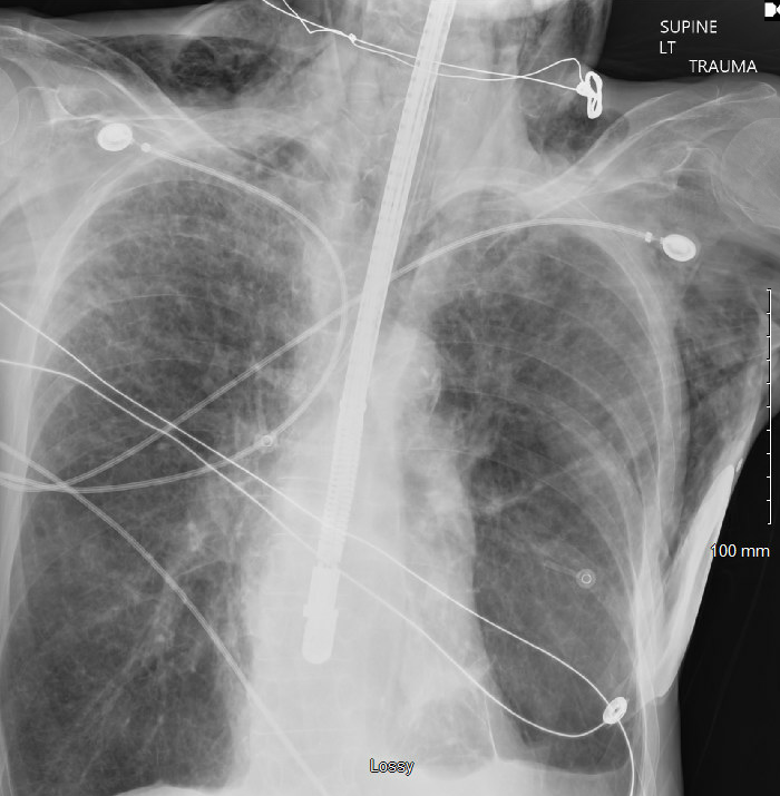 Scanning School - TEE Advanced: Cardiac Arrest Evaluation — Taming the SRU