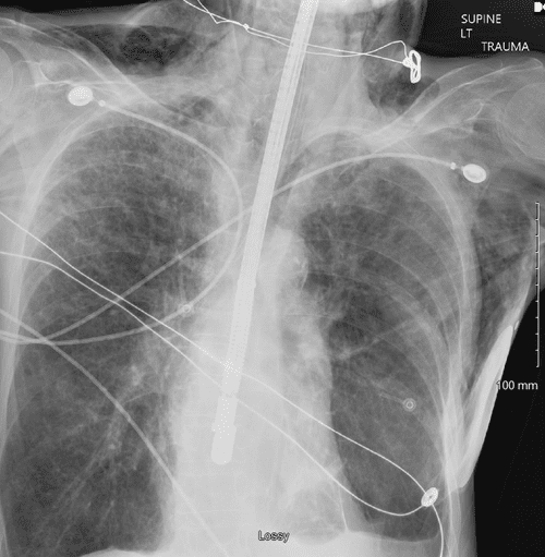 Scanning School - TEE Advanced: Cardiac Arrest Evaluation — Taming the SRU