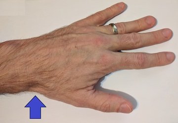 Mastering Minor Care: Hand Injuries — Taming the SRU