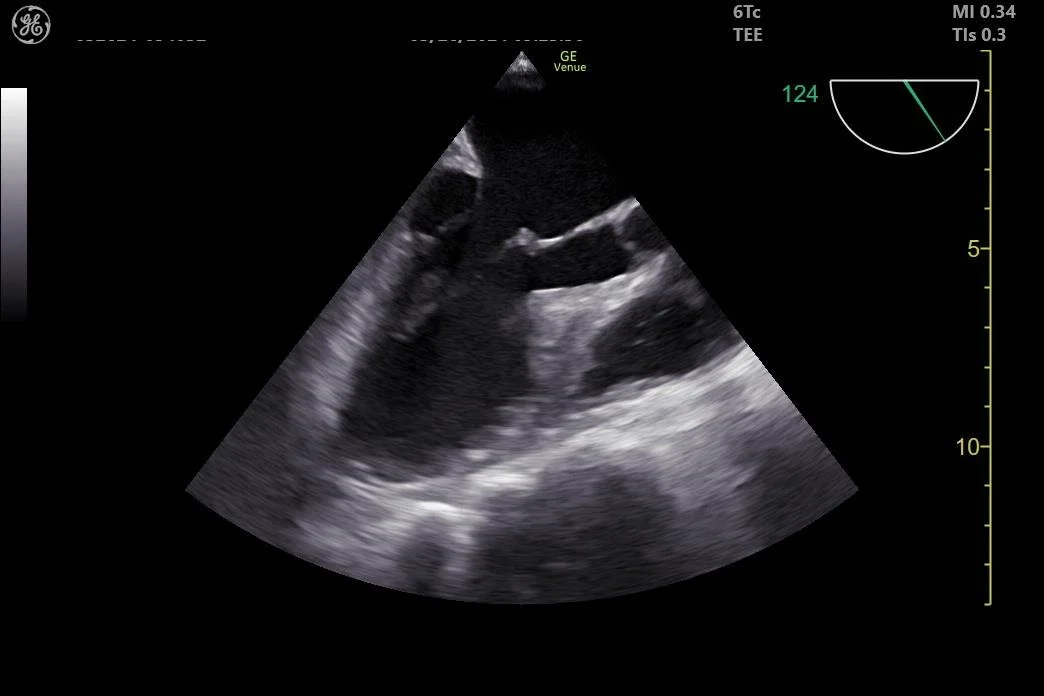 Scanning School - TEE Advanced: Cardiac Arrest Evaluation — Taming the SRU