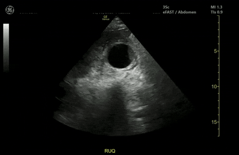 Scanning School - RUQ — Taming the SRU