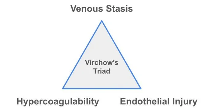 Diagnostics: Thromboembolic Disease in Pregnancy — Taming the SRU