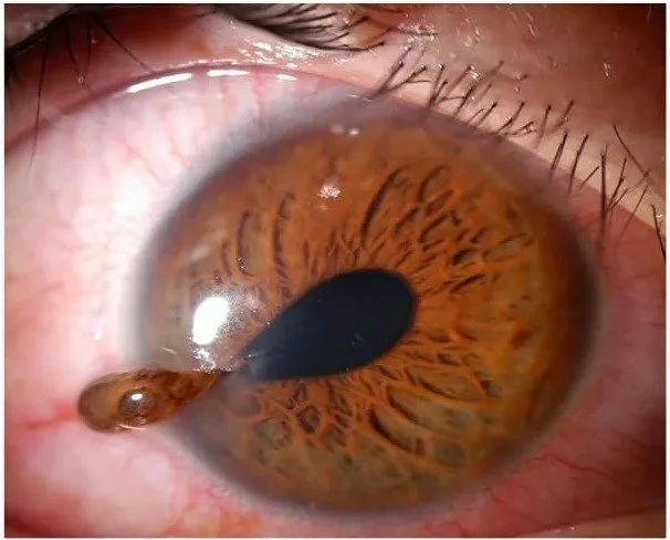 Diagnostics: Ophthalmologic Trauma — Taming the SRU