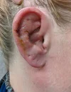 Diagnostics and Therapeutics: Ear Emergencies in the Department ...