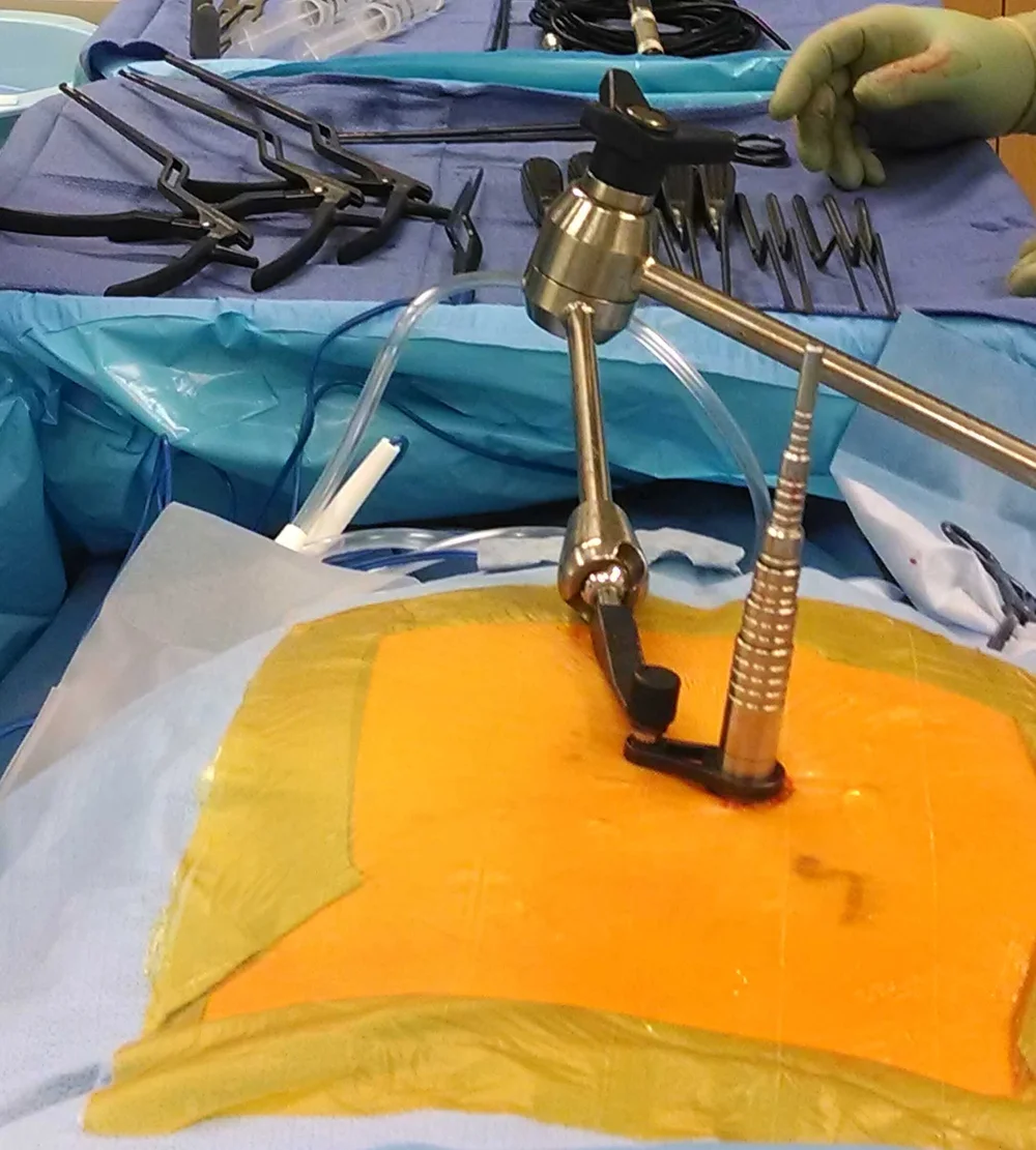 Disk Surgery Cases — Kenneth T. Kaan, M.D.