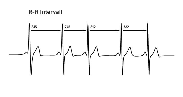 Heart Rate Variability Hrv — Burnout Protector©