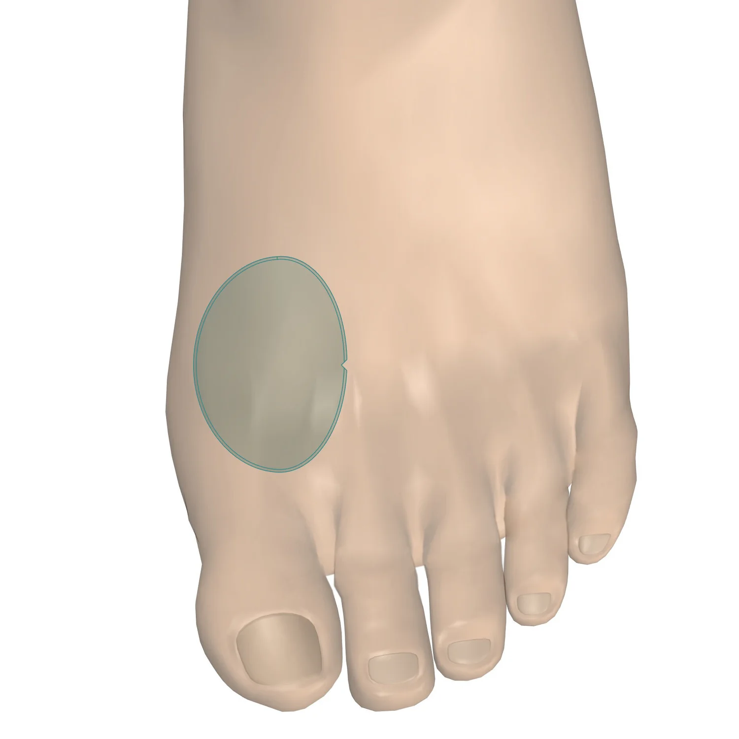 HBN Shoe - Insolia