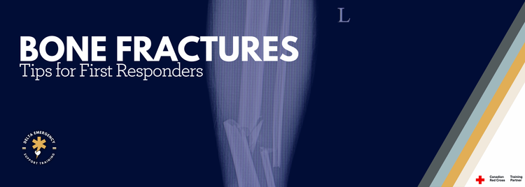 Fracture Care for First Responders: Comprehensive Guide to Managing ...