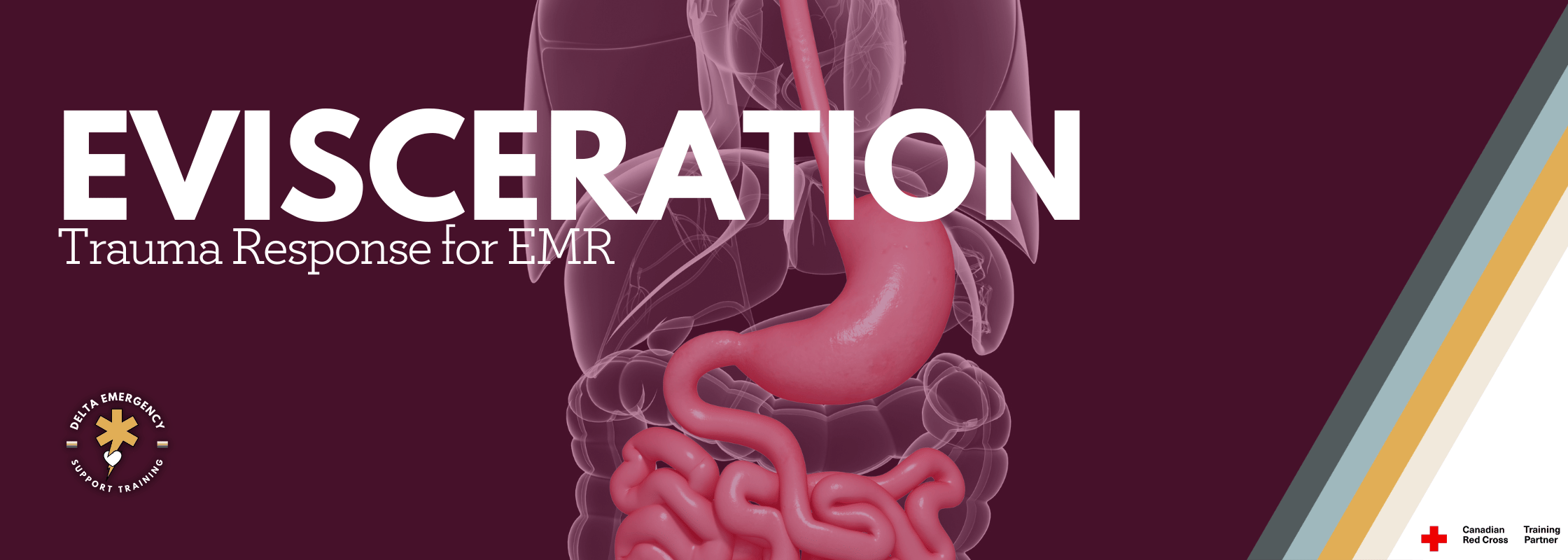 ow to Respond to Eviscerations: A Guide for EMRs and AFA Responders ...