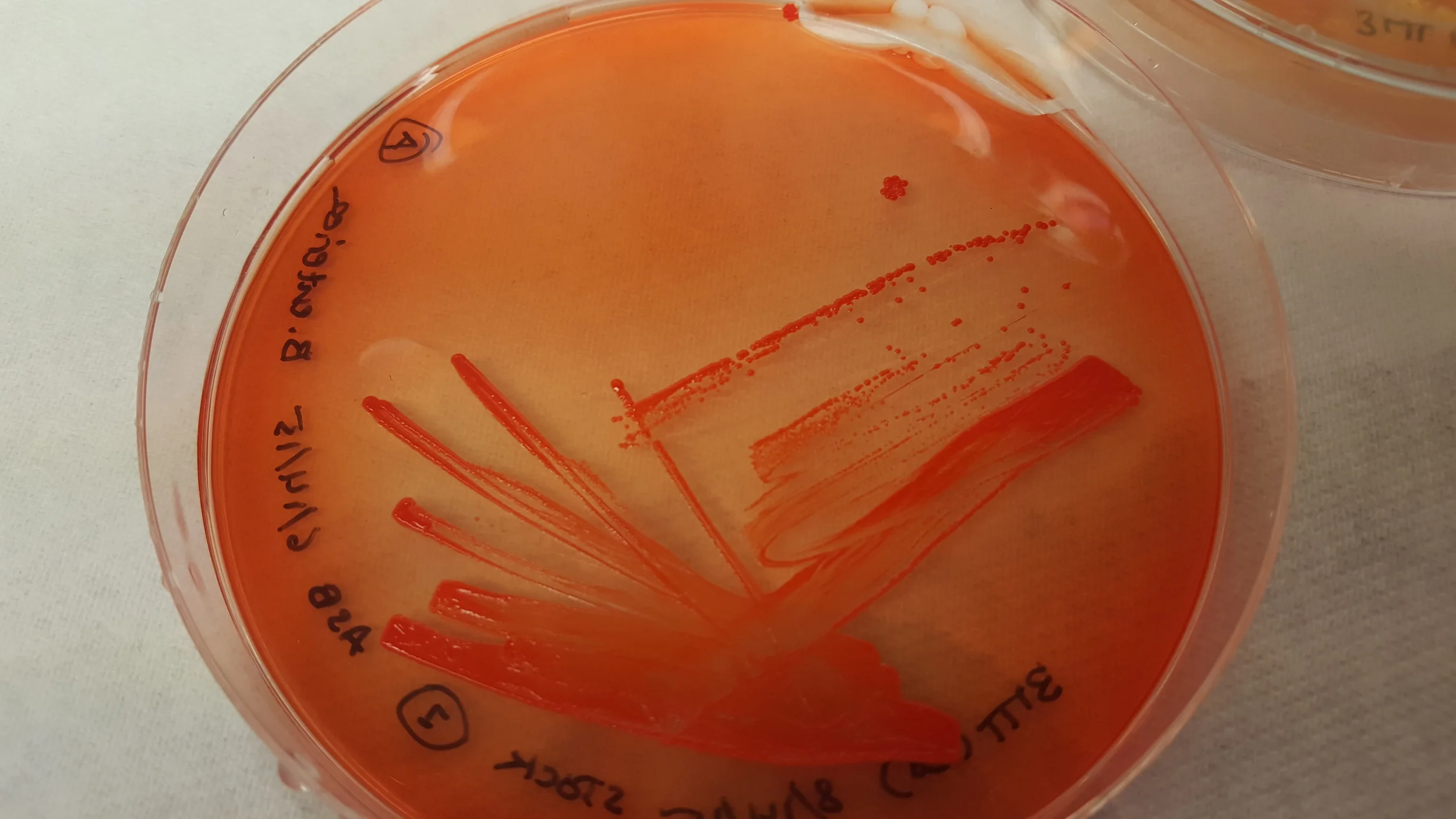 About — Bhatt Lab - Stanford Medical School