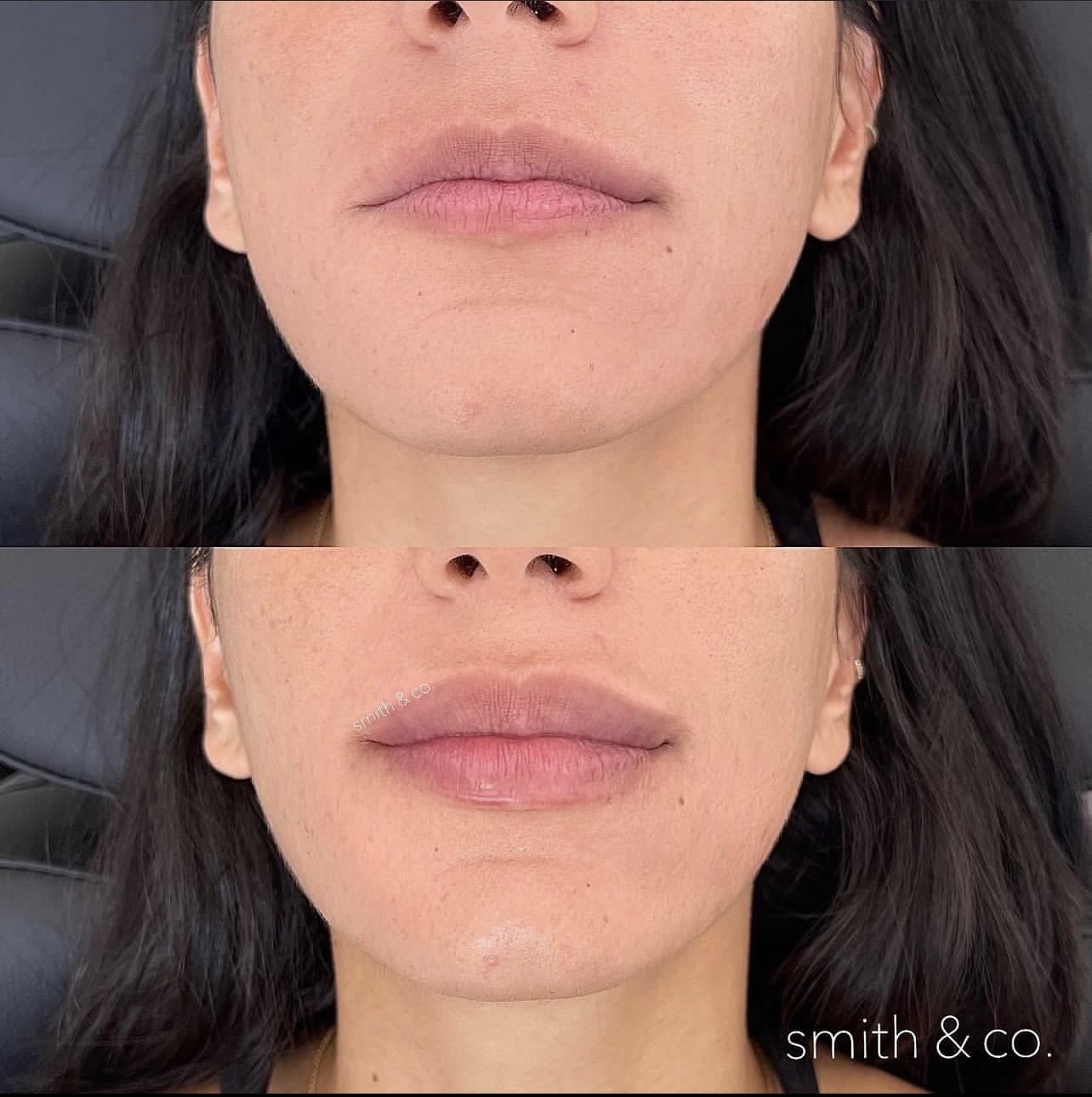 if i were a vial of botox... — Miami Beach Botox Specialist