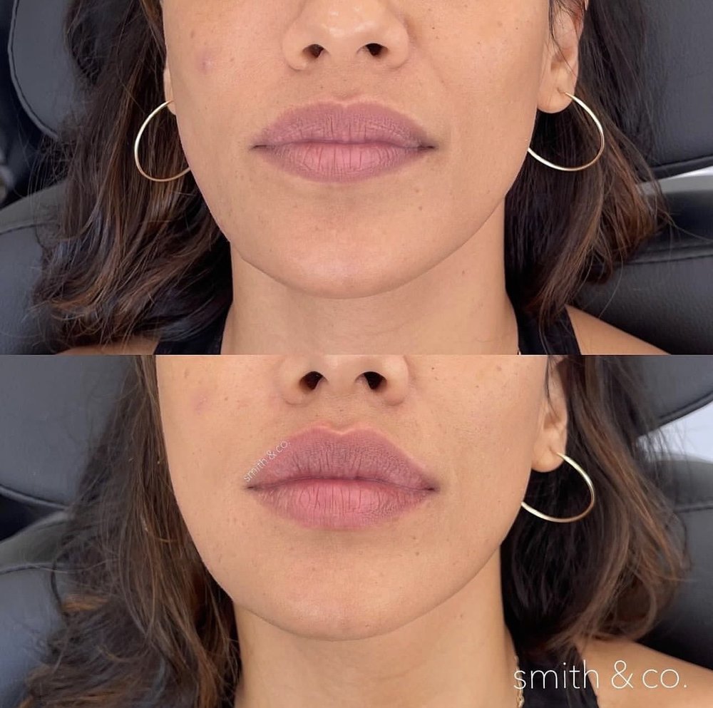 if i were a vial of botox... — Miami Beach Botox Specialist