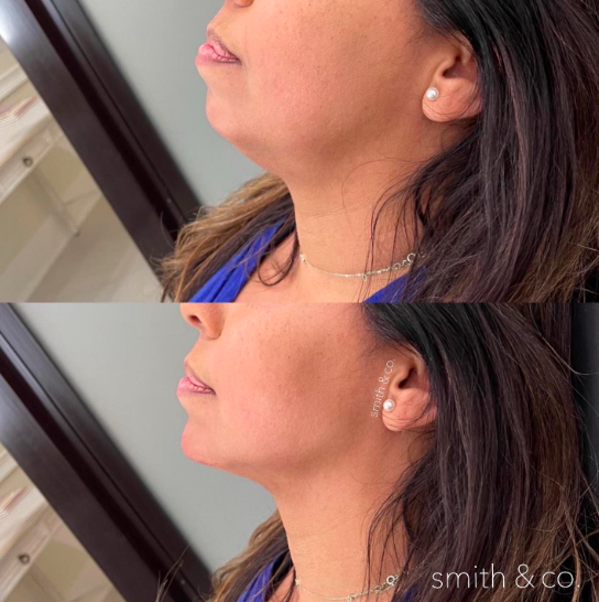 if i were a vial of botox... — Miami Beach Botox Specialist