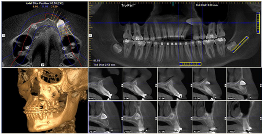 I Cat Cone Beam Radiation - The Best Picture Of Beam