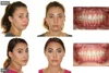 Arnett Gunson Before and After Images - Faces — SBFR | Gunson