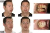 Arnett Gunson Before and After Images - Faces — SBFR | Gunson