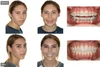Arnett Gunson Before and After Images - Faces — SBFR | Gunson