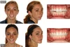 Arnett Gunson Before and After Images - Faces — SBFR | Gunson