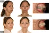 Arnett Gunson Before and After Images - Faces — SBFR | Gunson