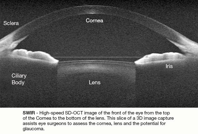 COMLY EYE CARE — Understanding Optical Coherence Tomography (OCT): What ...