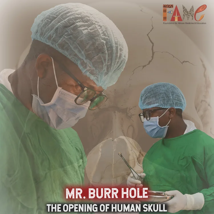 FAME | Mr. Burr Hole: The Opening of Human Skull