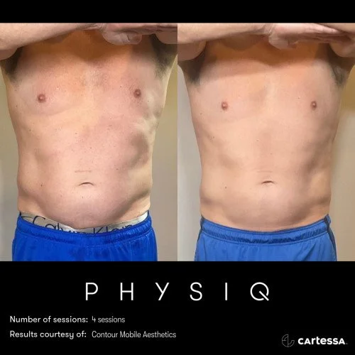 PHYSIQ Body Treatment | Beauty Bar by Heather, New Bern NC | Beauty Bar ...