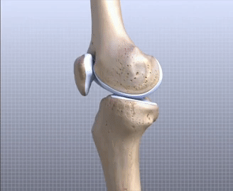 Medical Devices — Drake Smalley Design