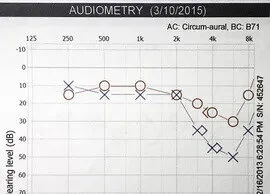 Services — Musicians Hearing Solutions