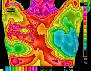 RADIANT BODY THERMOGRAPHY