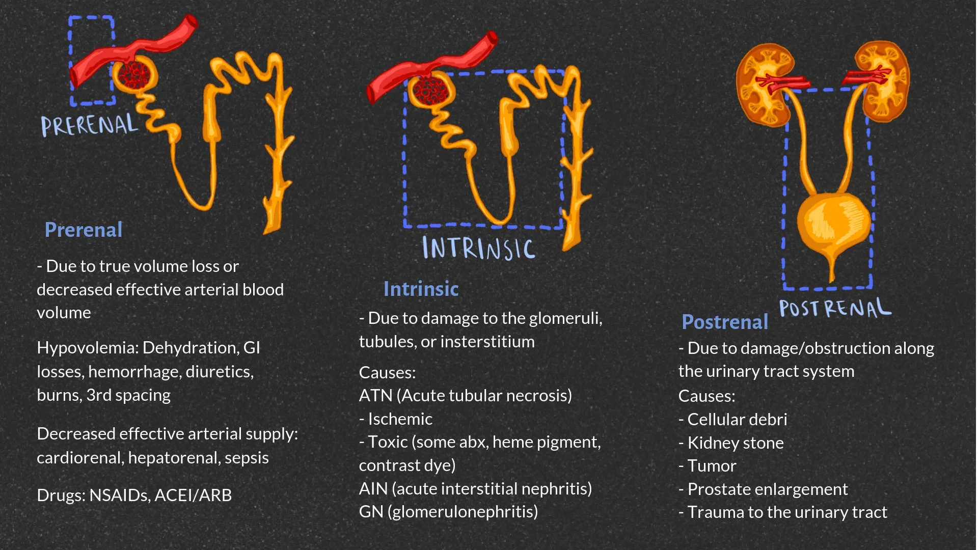 Acute Kidney Injury with Dr. Liza Cholin — Louisville Lectures
