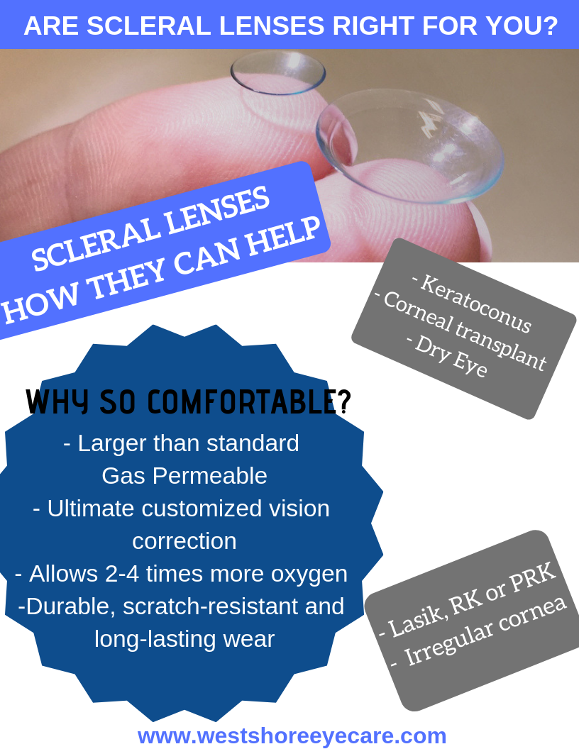 Scleral Lens — West Shore Eye Care