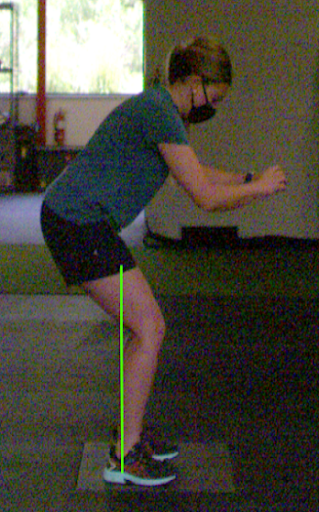 Accelerate your ACL Rehab in the first 4 weeks — Revo Physiotherapy ...