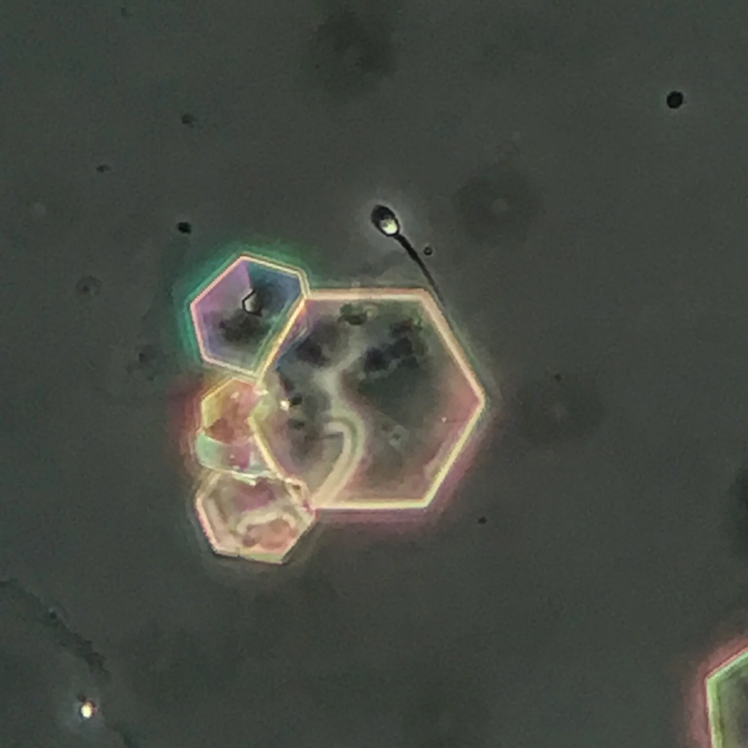 Cystine Crystal Gallery — @swissnephro