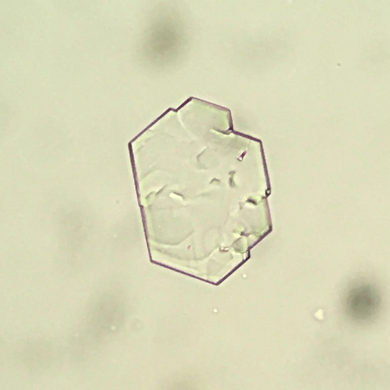 Cystine Crystal Gallery — @swissnephro