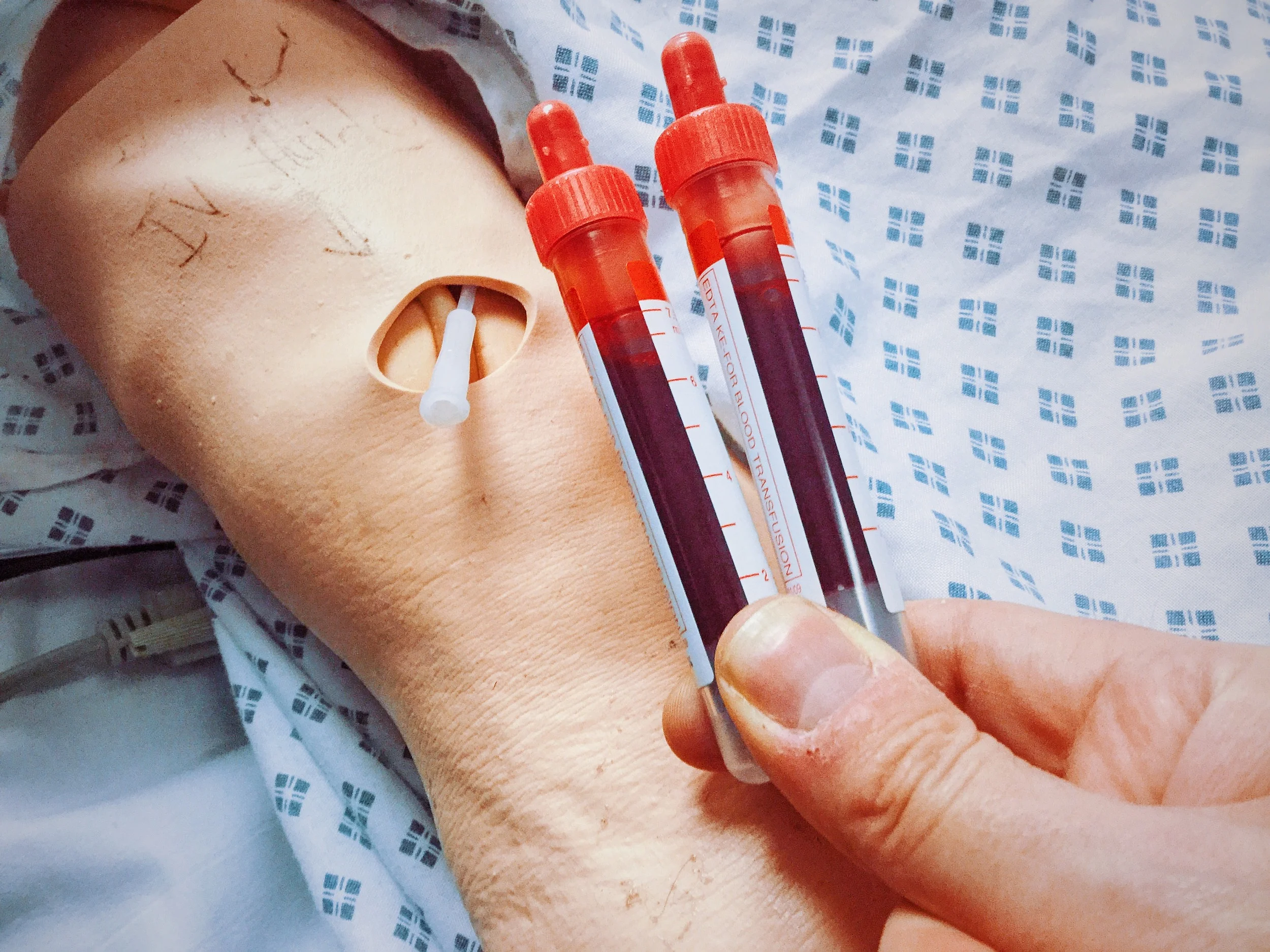 #SimBlog: Major Haemorrhage — #EM3: East Midlands Emergency Medicine ...