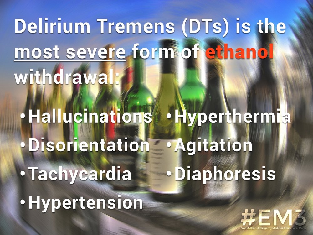 #SimBlog: The Silver Swiller — EM3