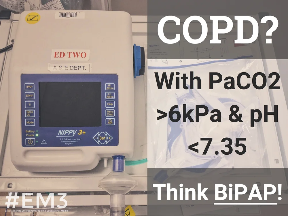 #SimBlog: Type 2 Respiratory Failure — EM3