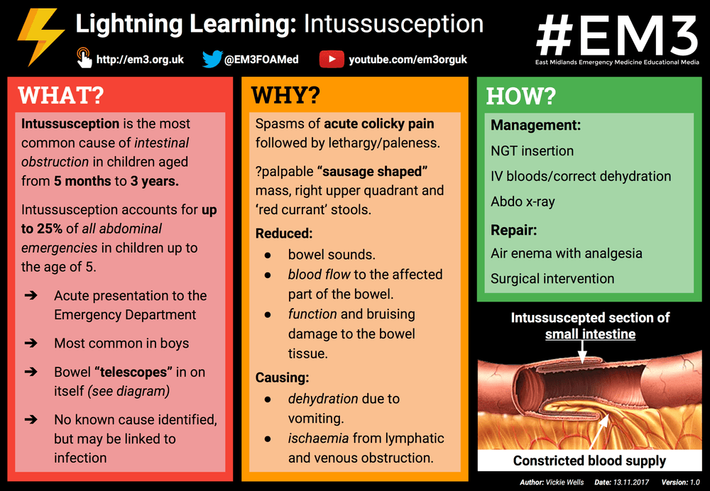 Lightning Learning: Intussusception — EM3