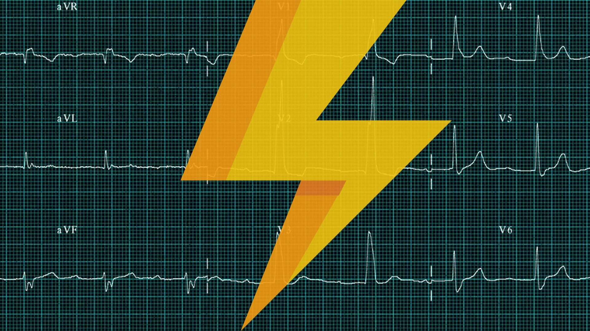 Lightning Learning: Orthostatic Hypotension — EM3