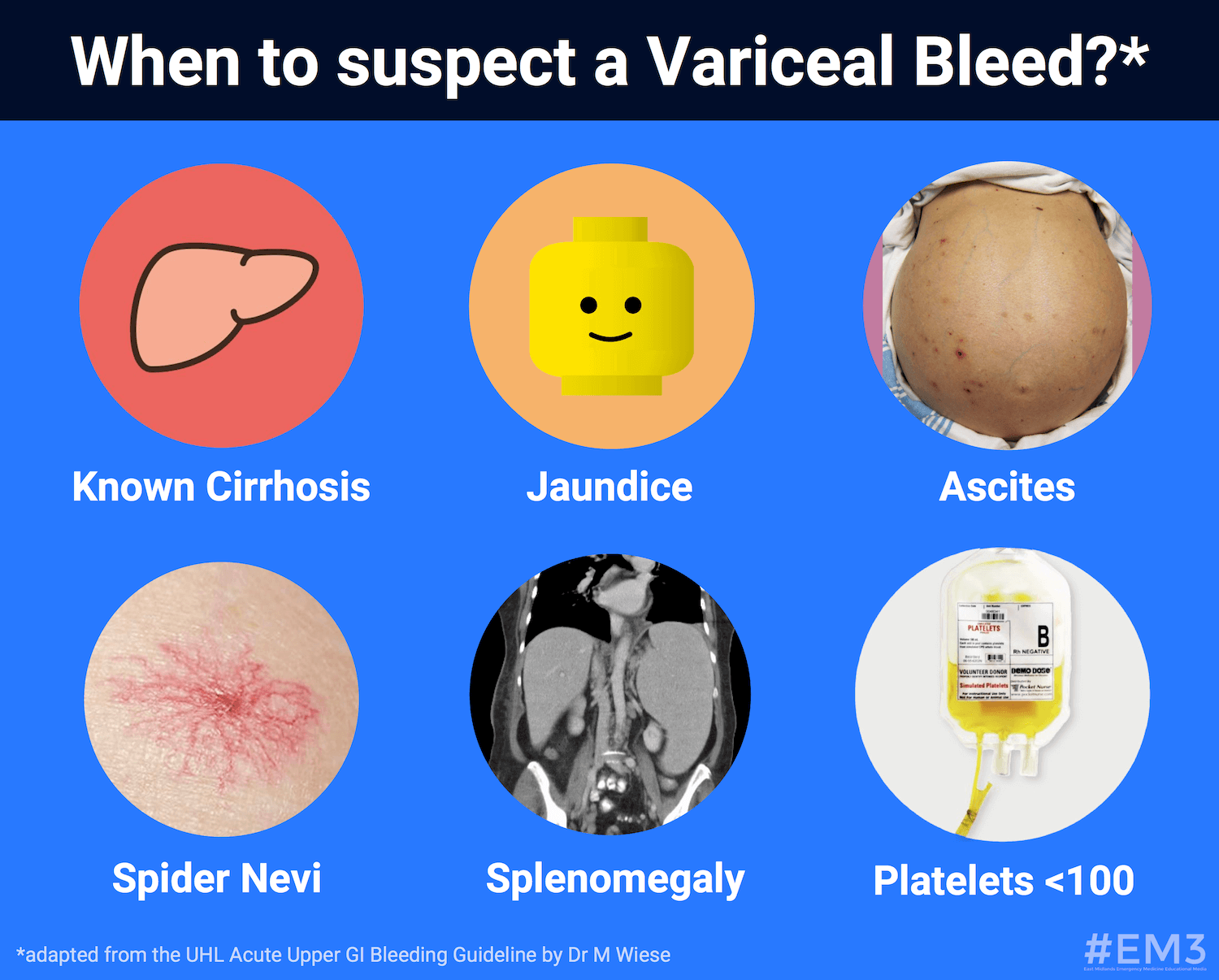 #SimBlog: Major Haemorrhage — EM3