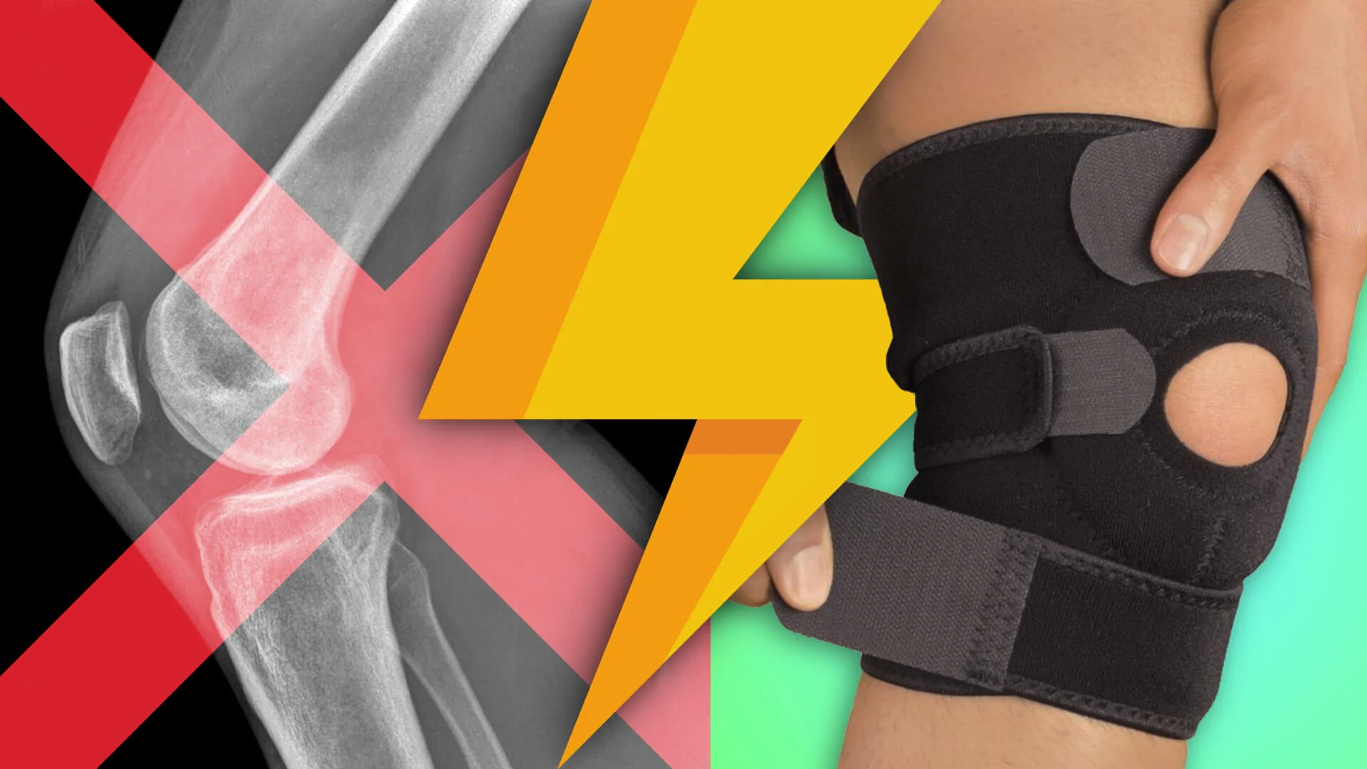 Lightning Learning: Ottawa Knee Rules — #EM3: East Midlands Emergency ...
