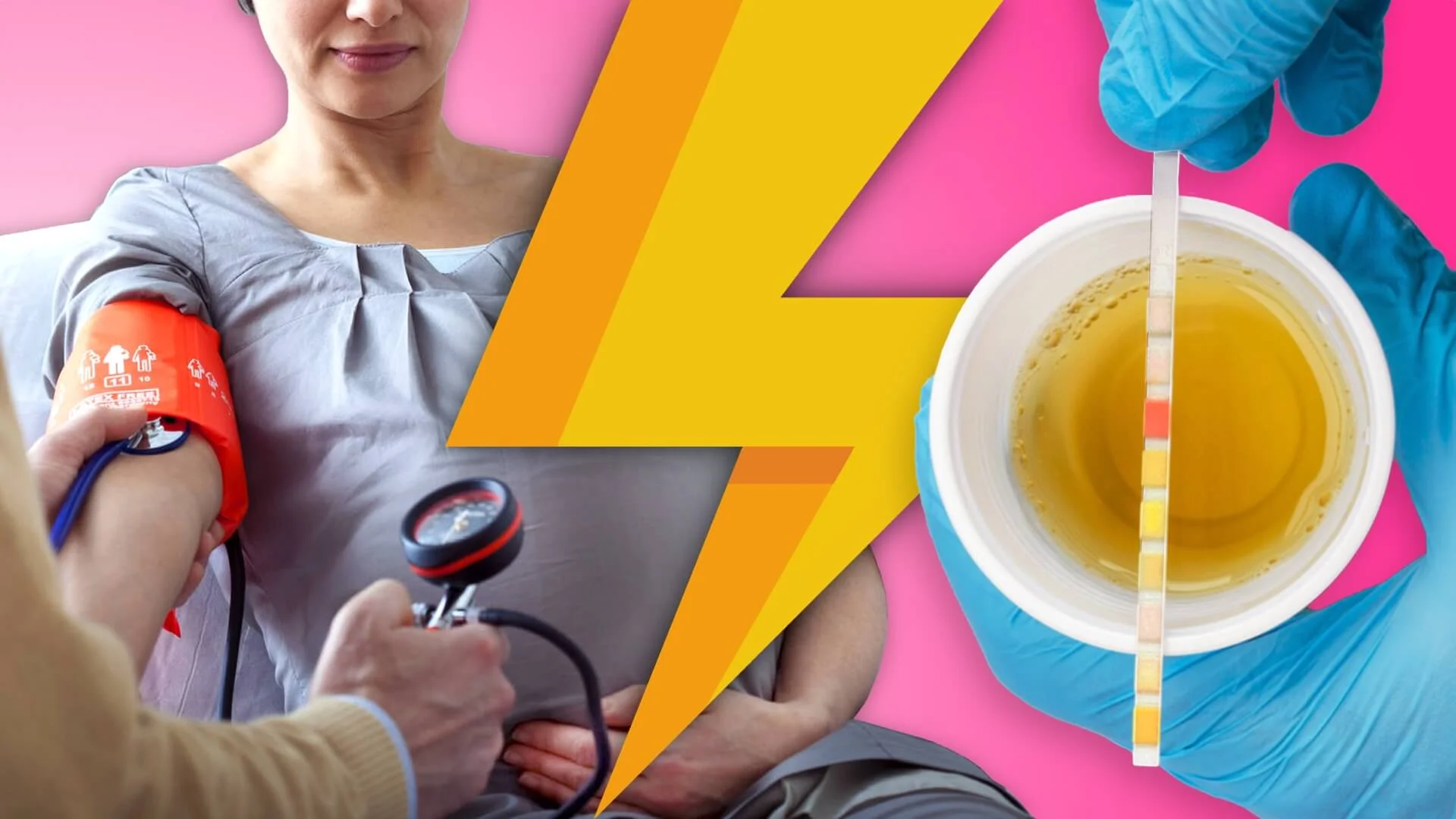 Lightning Learning: Pre-eclampsia — EM3